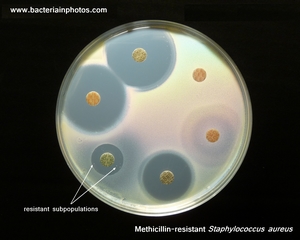 MRSA under microscope (methicillin-resistant Staphylococcus aureus), morphology and microscopic ...